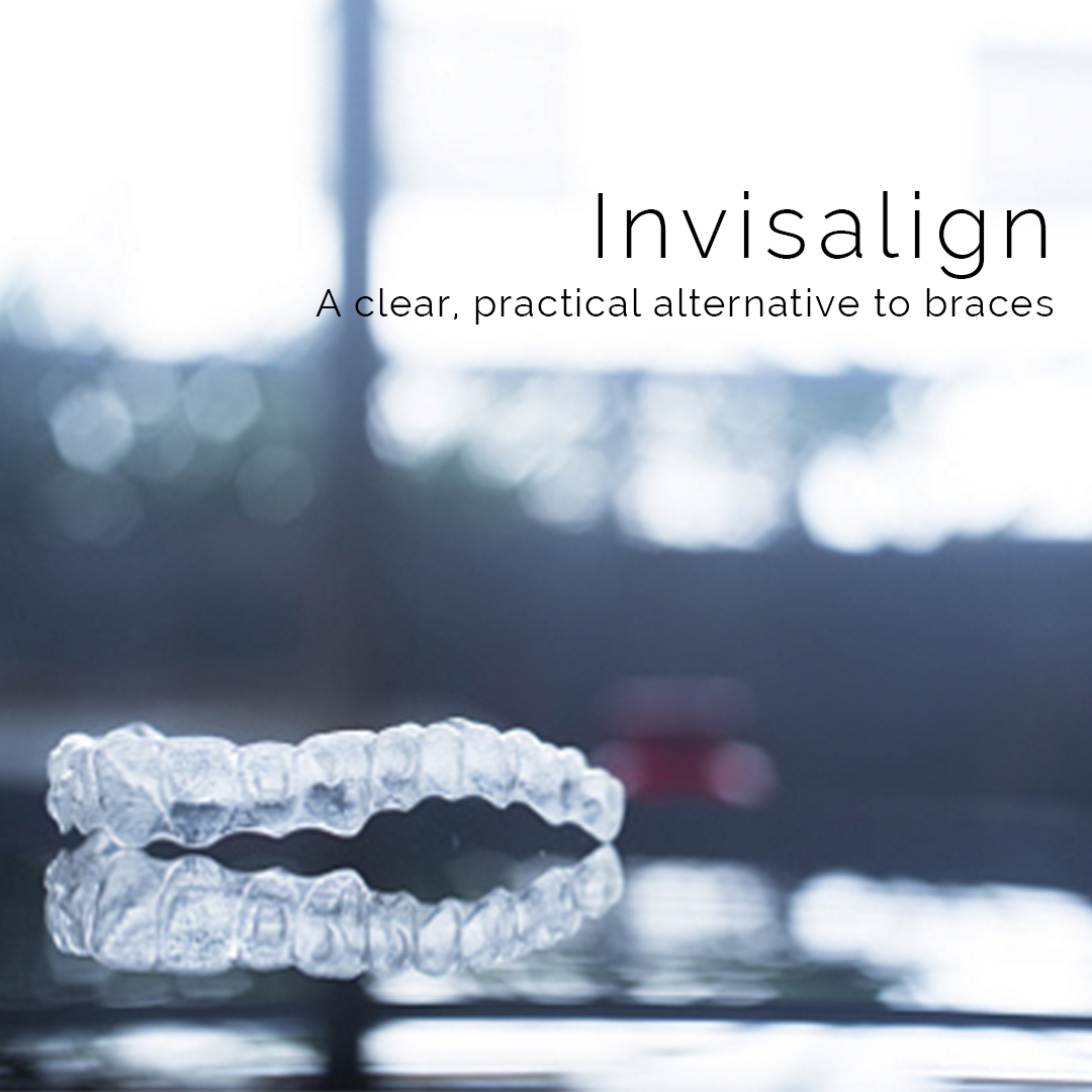 Fort Worth Orthodontist | Ahava Orthodontics | Invisalign Treatment
