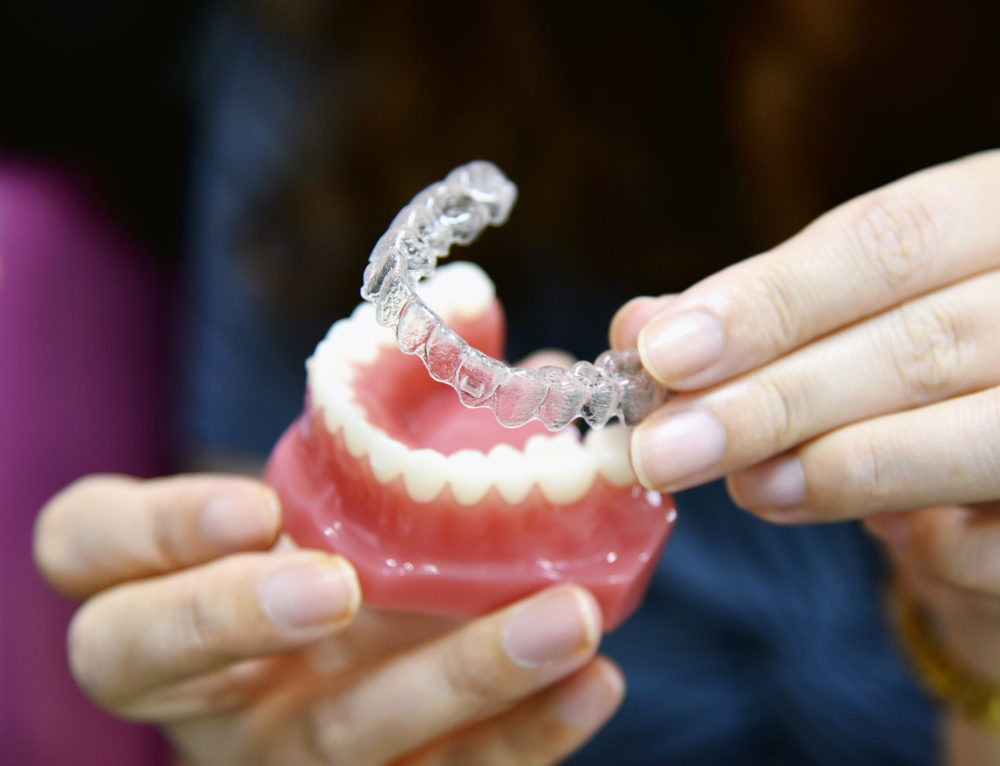 What To Do When You Have a Broken Retainer | Ahava Orthodontics