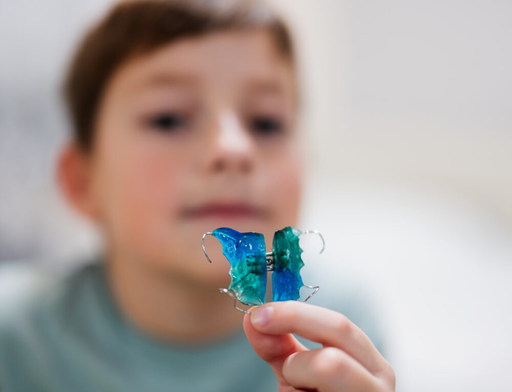 What To Do When You Have a Broken Retainer | Ahava Orthodontics