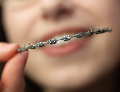 What Happens When The Braces Come Off | Ahava Orthodontics