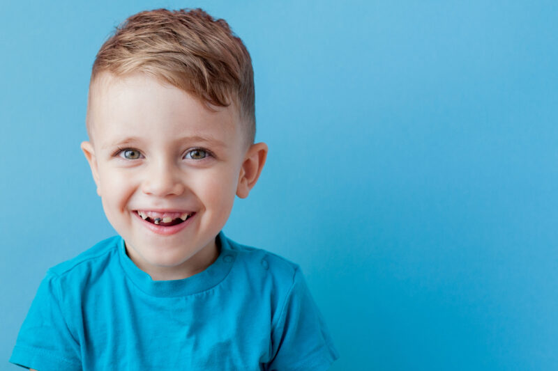 What Causes Crooked Teeth? Exploring the Real Reasons Behind Misaligned ...