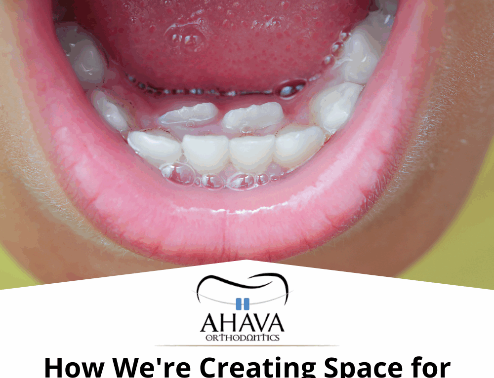 What To Do When You Have a Broken Retainer | Ahava Orthodontics