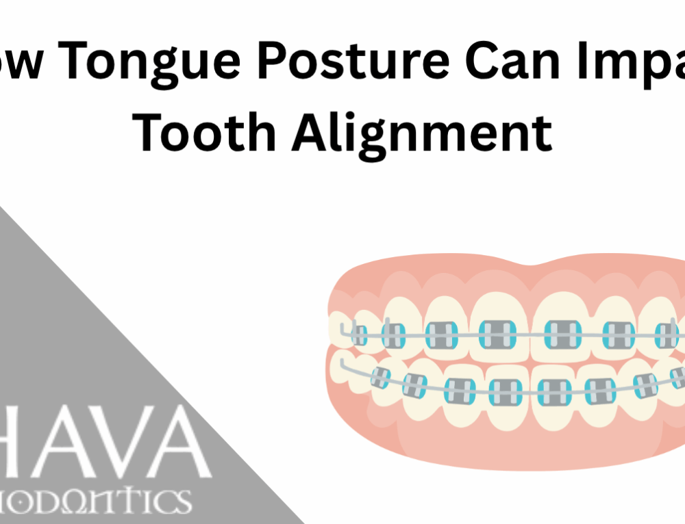How the Myobrace Works | Ahava Orthodontics